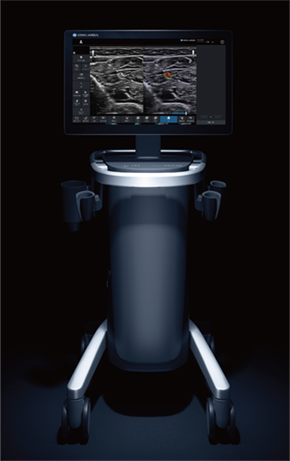 SONIMAGE UX1 TRiFOR（超音波・据え置き） - コニカミノルタジャパン株式会社