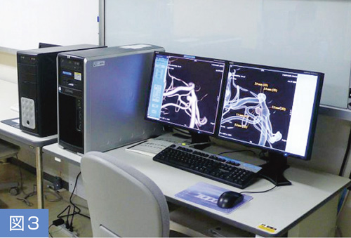 図3 Advantage Workstation VS2のモニタ