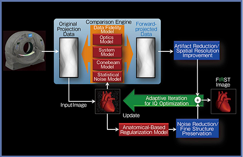 First技術紹介 ─ Forward Projected Model Based Iterative Reconstruction Solution