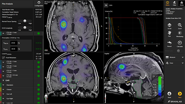 Brainlab®Elements Elements Multiple Brain Mets SRS，Elements Cranial SRS，Elements Spine SRS（高精度 ...