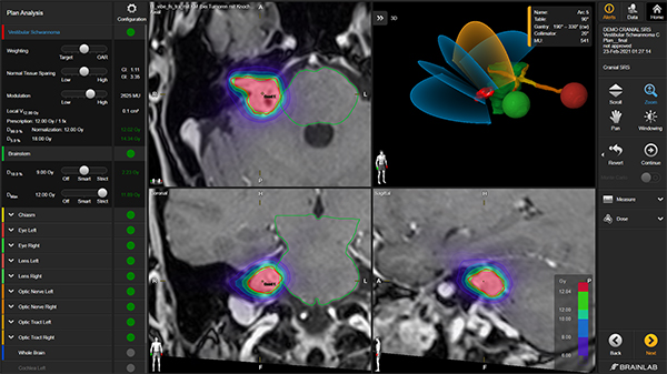 Brainlab®Elements Elements Multiple Brain Mets SRS，Elements Cranial SRS ...
