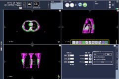 CT-Linac（CT同室設置型放射線治療システム）（放射線治療・全般） - キヤノンメディカルシステムズ株式会社
