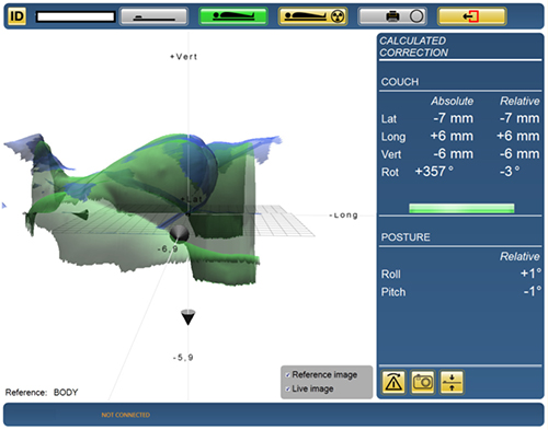 Elekta Infinity（放射線治療・全般） - キヤノンメディカルシステムズ株式会社