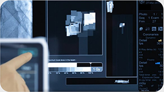 Allia IGS 540 - X線血管撮影装置 デジタル（FPD）-（GEヘルスケア・ジャパン株式会社）