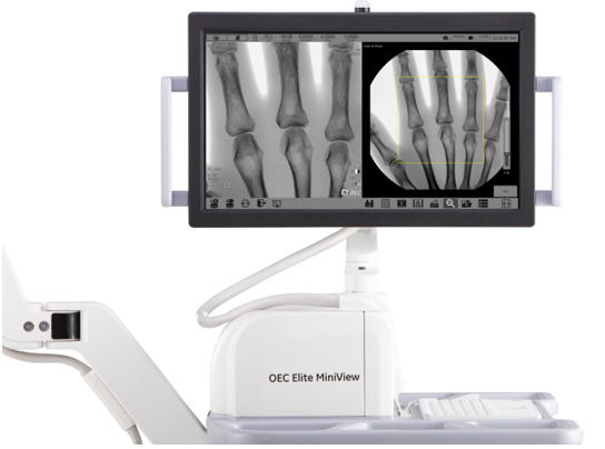 OEC MiniView（X線移動型装置 デジタル（FPD））- GEヘルスケア・ジャパン株式会社