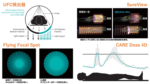 Symbia Intevo（SPECT・CT）- シーメンスヘルスケア株式会社