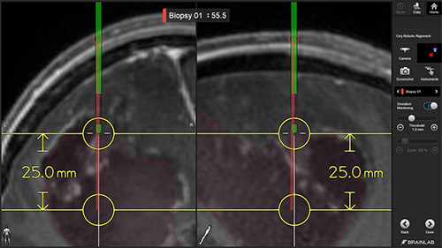 Cirq ロボットアームシステム - ブレインラボ株式会社